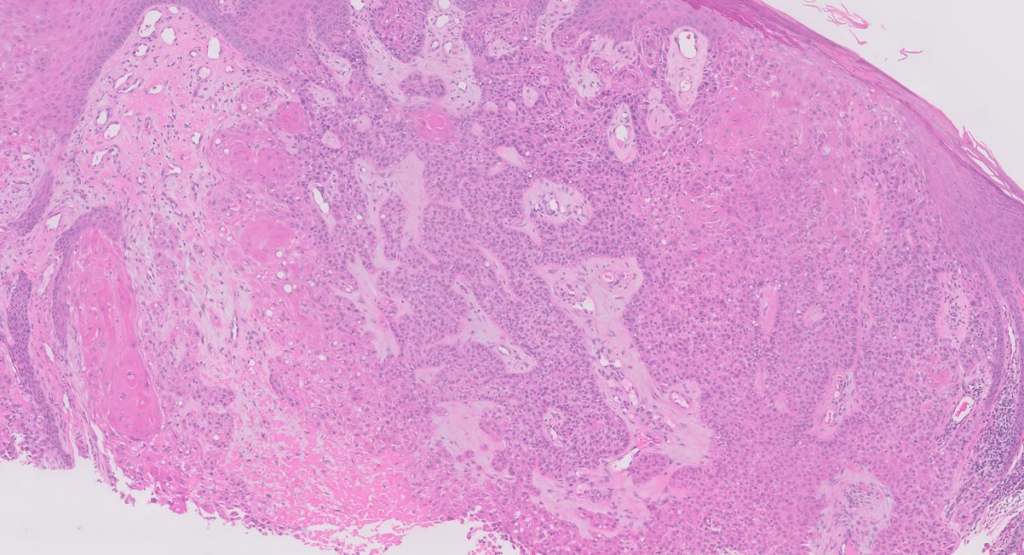 Dermatopathology - Aspire Skin Health