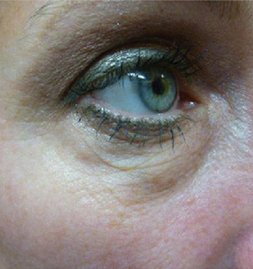 SkinTyte - Aspire Skin Health