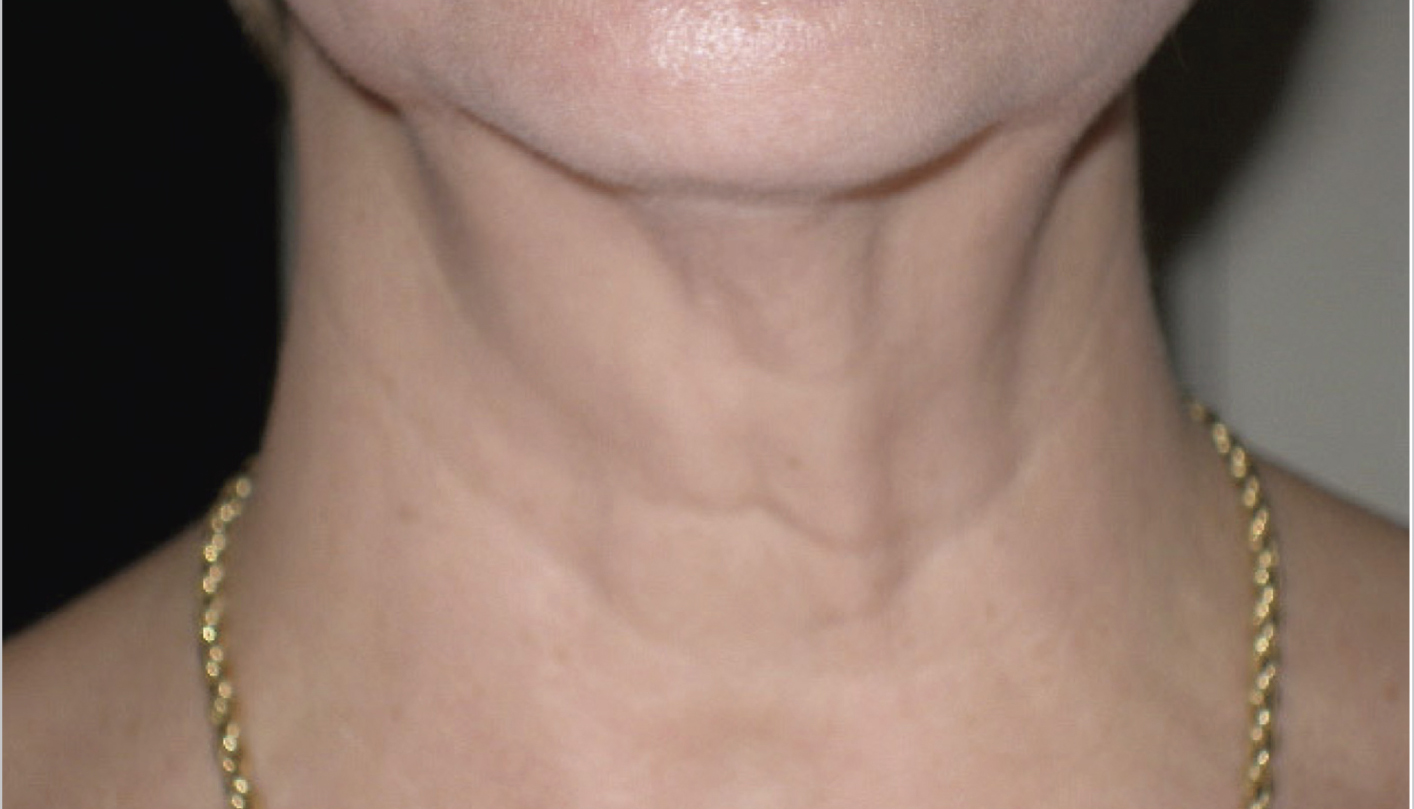 SkinTyte - Aspire Skin Health