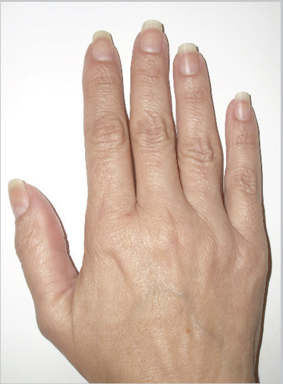 SkinTyte - Aspire Skin Health